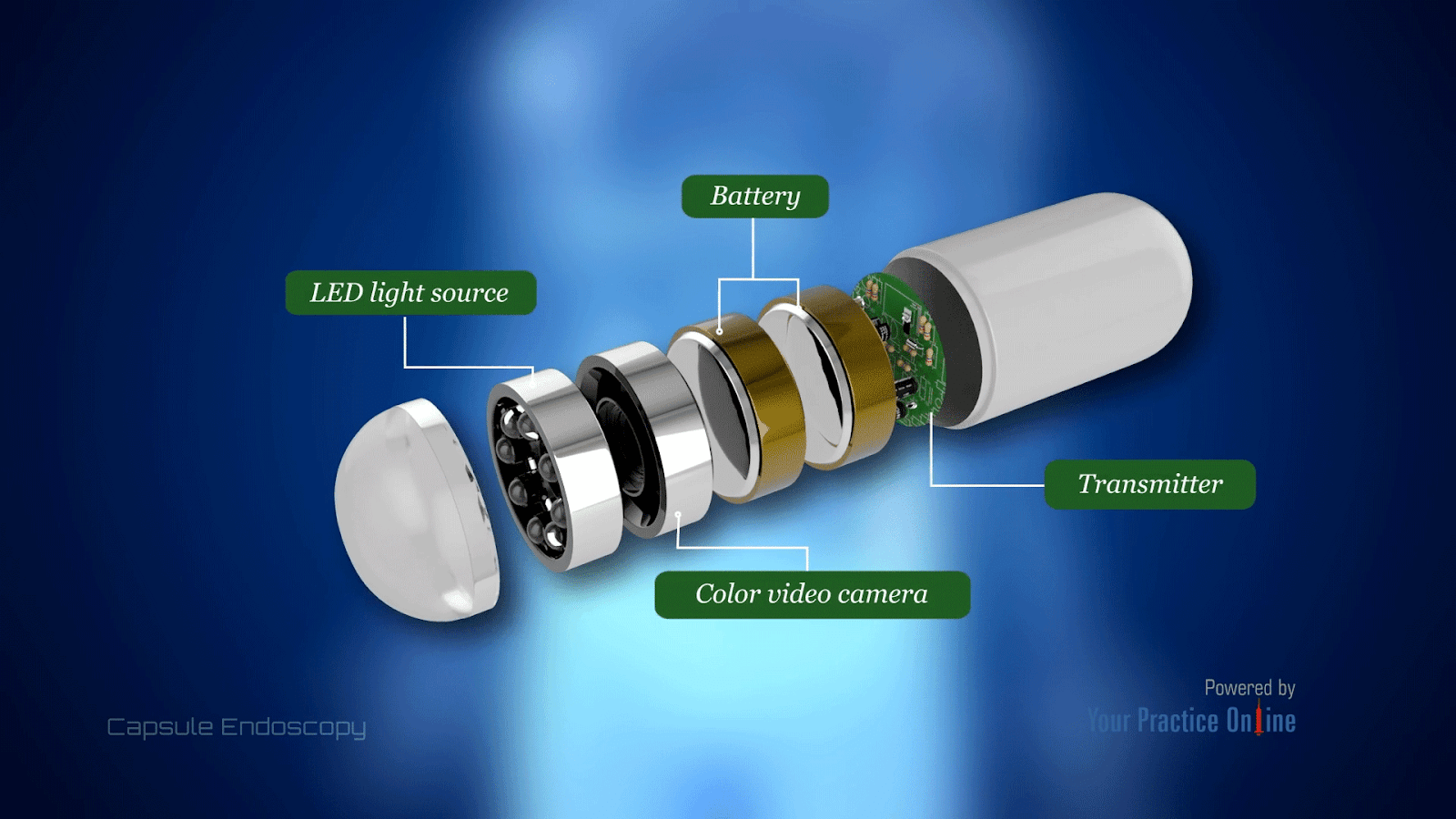 All about Capsule Endoscopy by a Gastroenterologist in Delhi